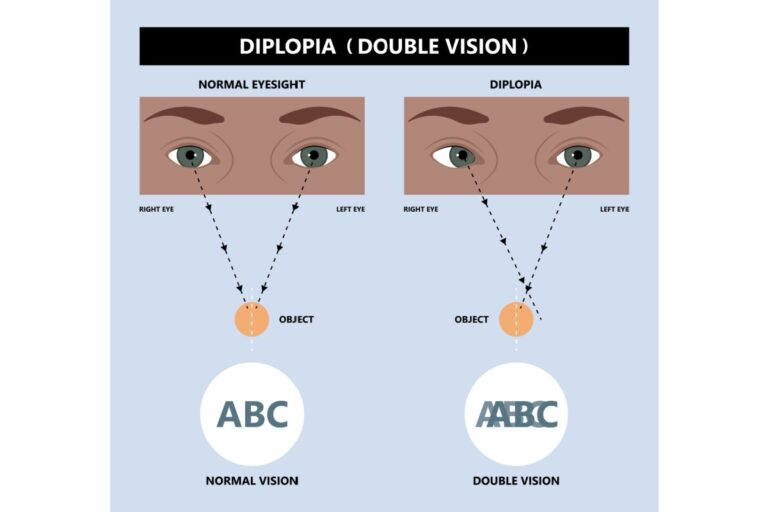What Are Prism Glasses & How Do They Work?