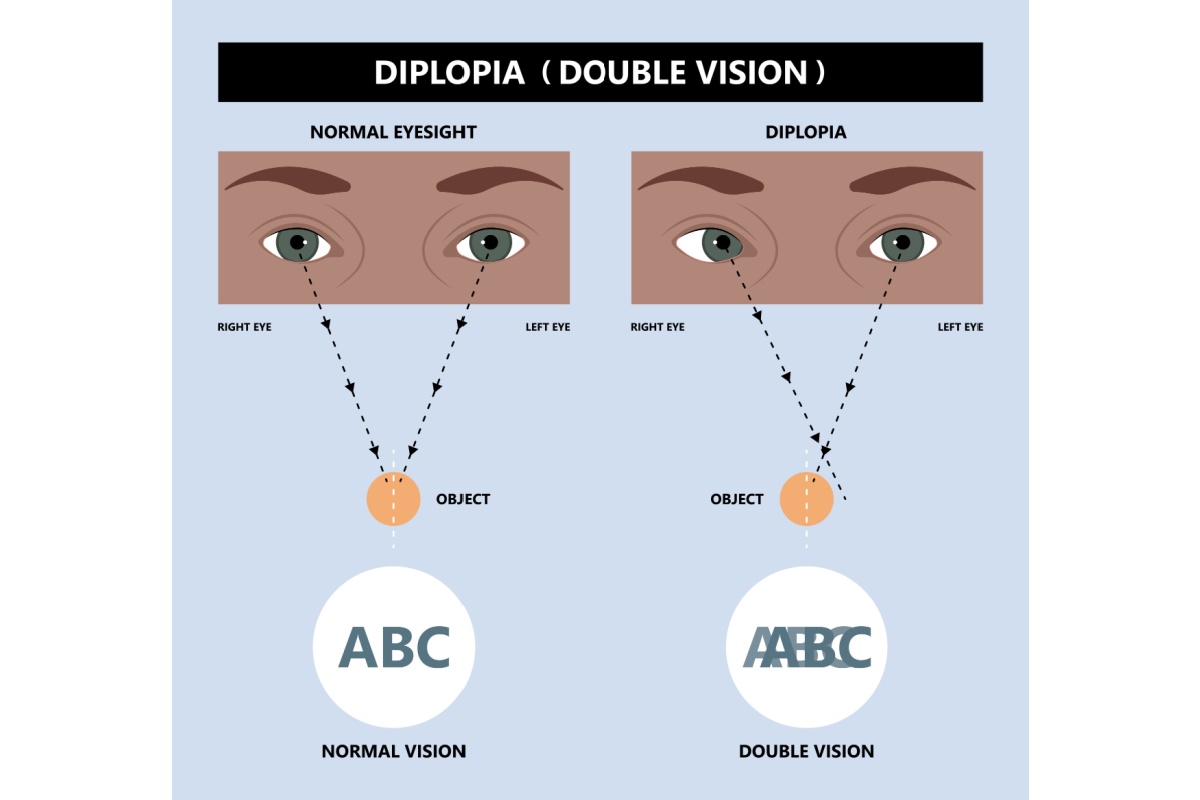 What Are Prism Glasses & How Do They Work?
